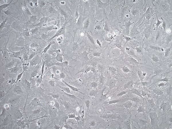 OP9-DL1 hDL-1-Expressing mOP9 Cell Line | SCC136